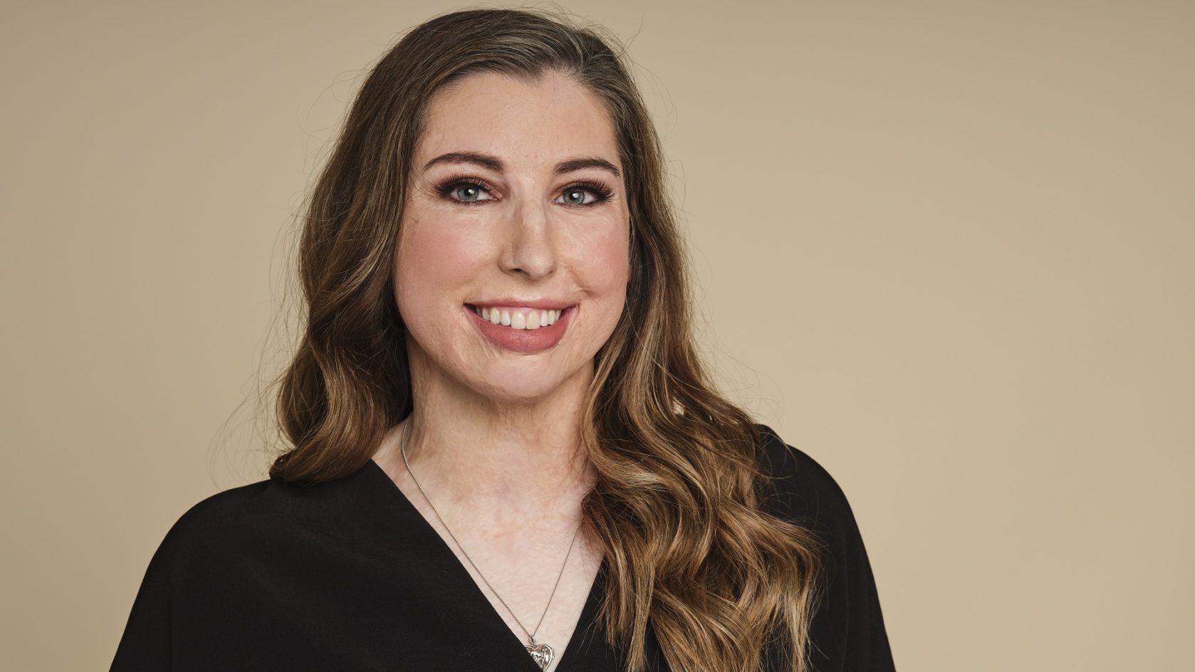 Our Ambassadors | Visible Difference Charity | Changing Faces