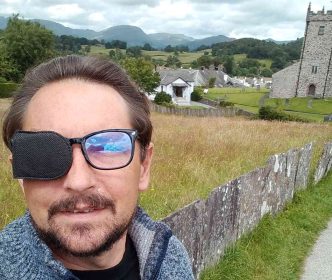 Changing Faces | Visible Difference & Disfigurement Charity