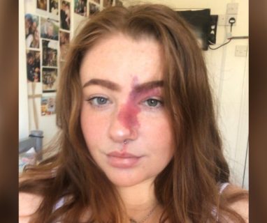 Caitlin: It’s Important To Have Role Models - Changing Faces