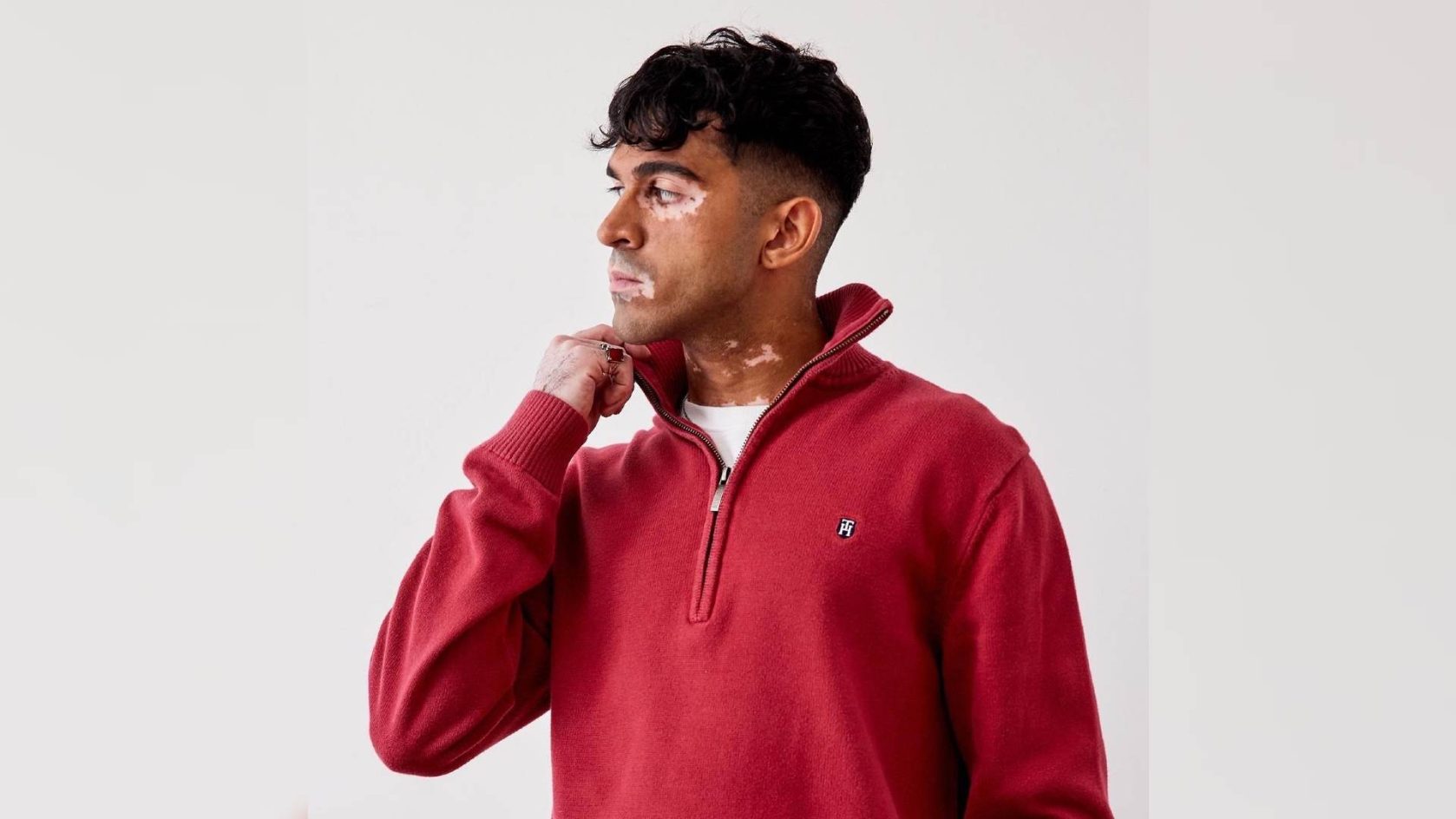 Our Campaigners | Visible Difference Charity | Changing Faces