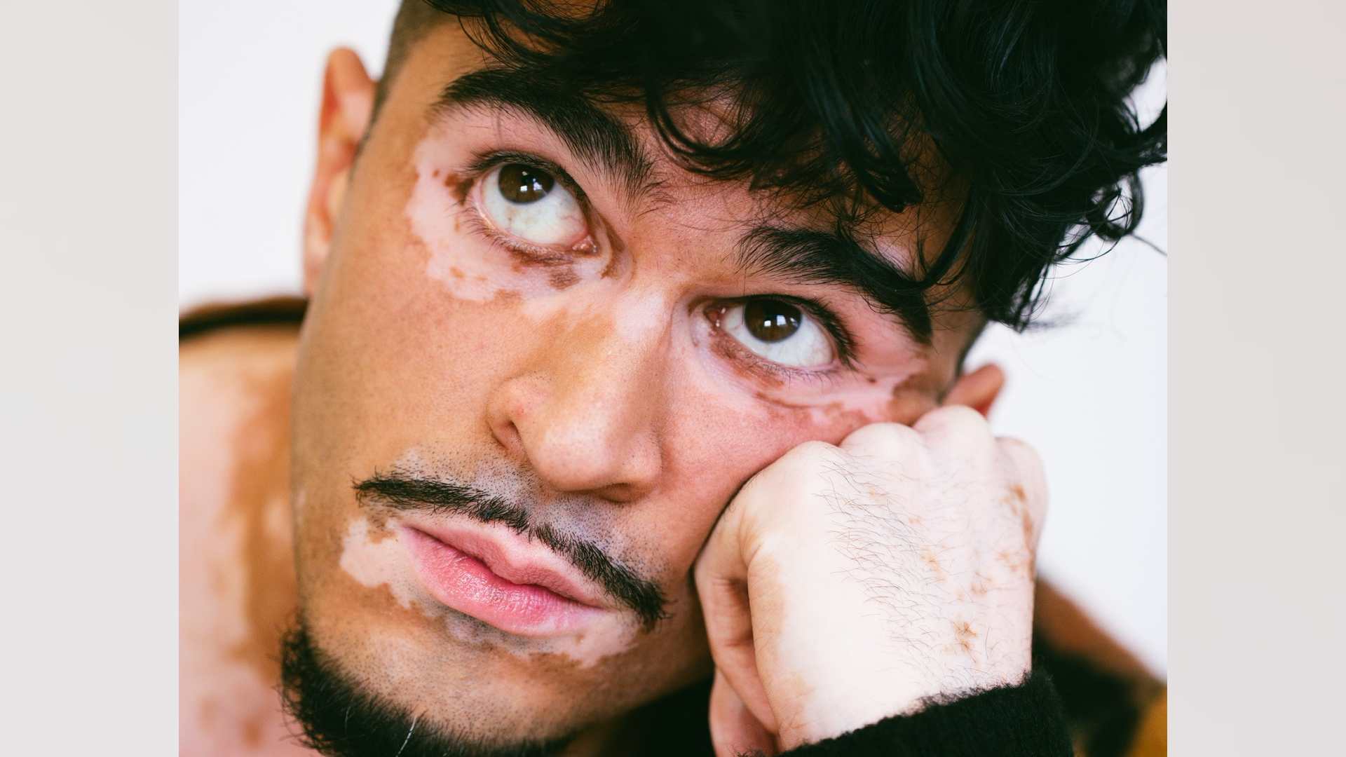 Sultan’s Story: “See Your Difference As A Superpower”