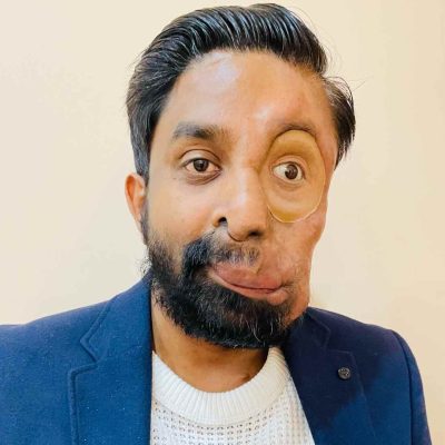 Amit’s Story: “Allow Your Personality To Shine Through”