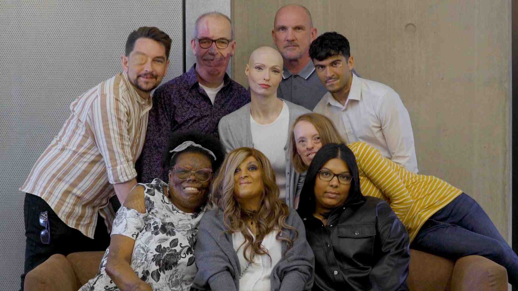 This Face Equality Week, We’re Calling For More Positive Representations Of Visible Difference