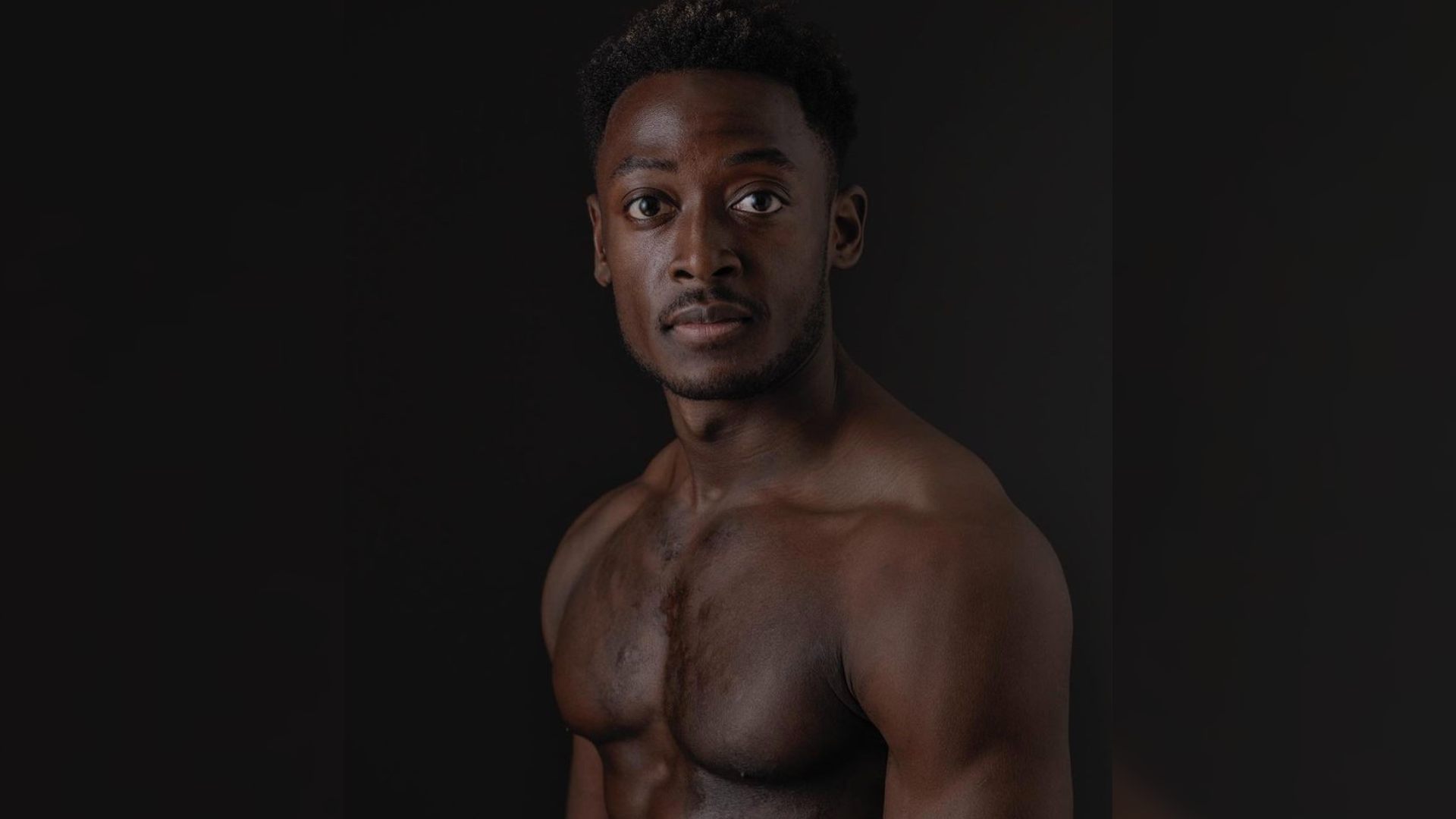 Romeo’s Story: “Self-confidence is power” - Changing Faces