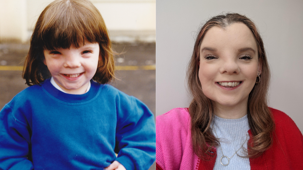 Cari’s story – “People with visible differences can achieve anything ...