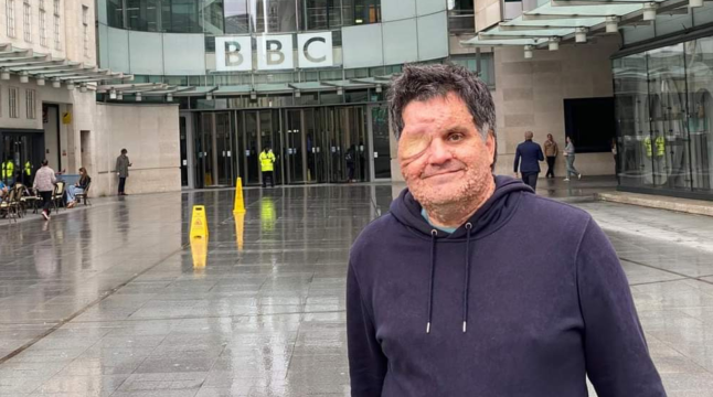 Real Stories By People With Disfigurements | Changing Faces