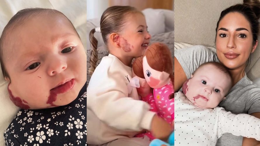 Changing Faces | Visible Difference & Disfigurement Charity