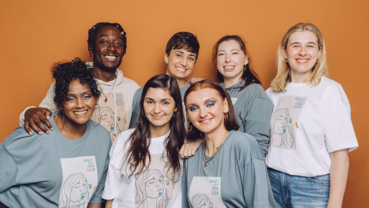 Anthony Lexa: “Beauty isn’t skin deep.” - Changing Faces