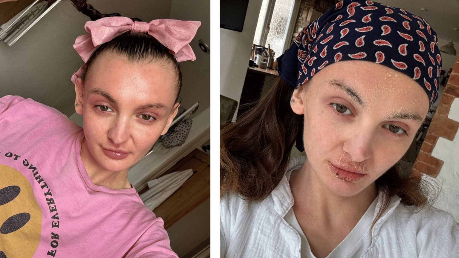 Anthony Lexa: “The older I get, the more people surprise me ...