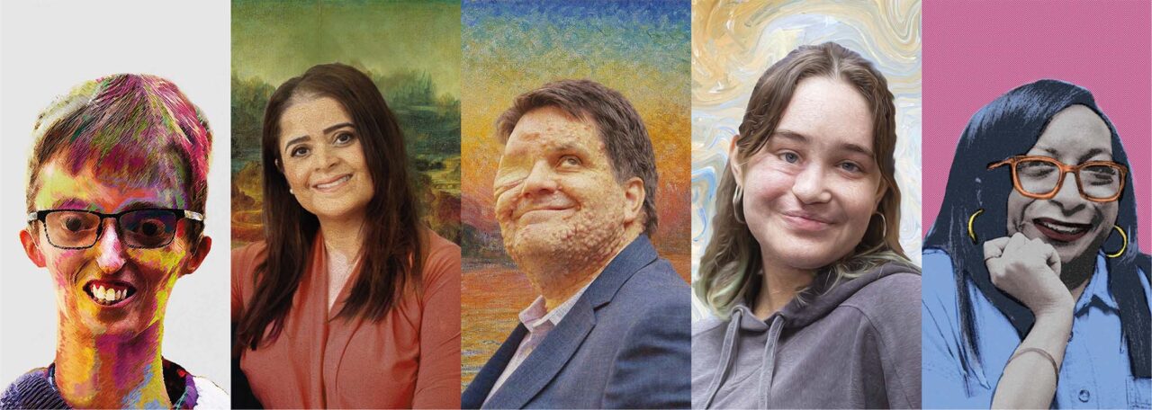 Face Equality Week | Visible Difference | Changing Faces