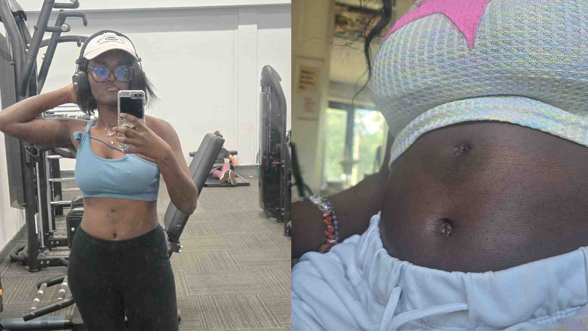 Empowerment through embracing your scars - Changing Faces